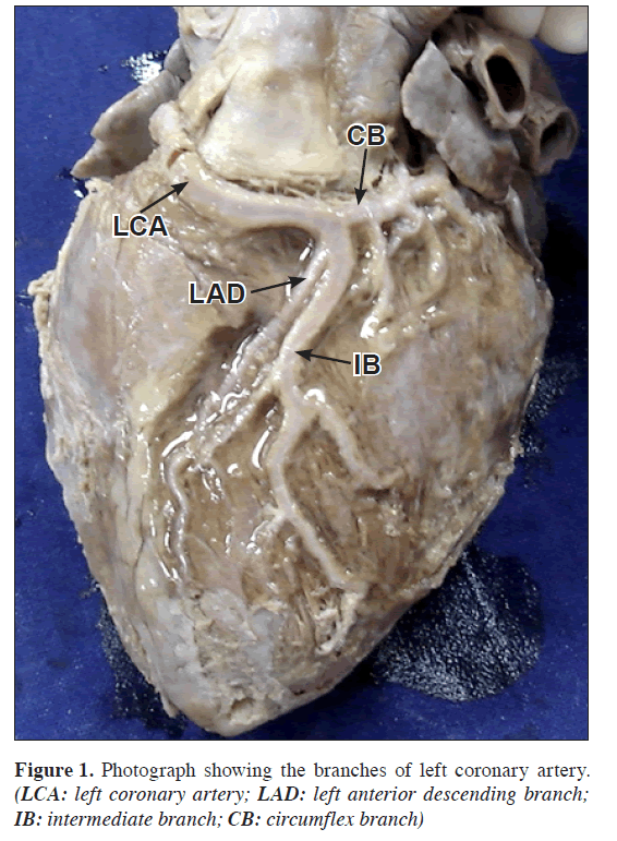Independent origin of the entire coronary system along with the right ...