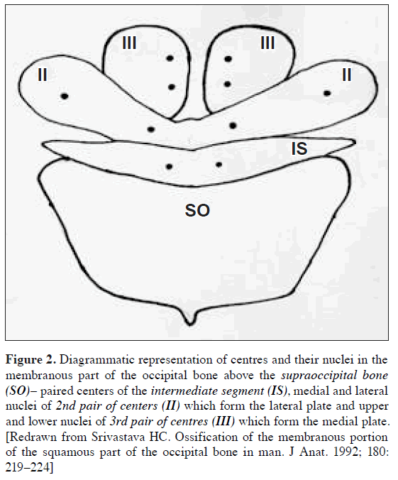 Interparietal (Inca) bone: a case report