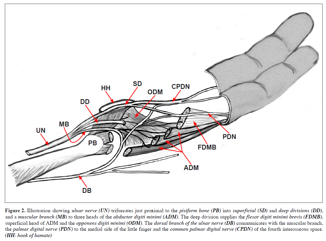 Anatomical variations in the ulnar nerve and hypothenar muscles