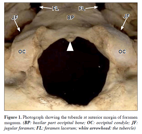 A tubercle at the anterior margin of foramen magnum