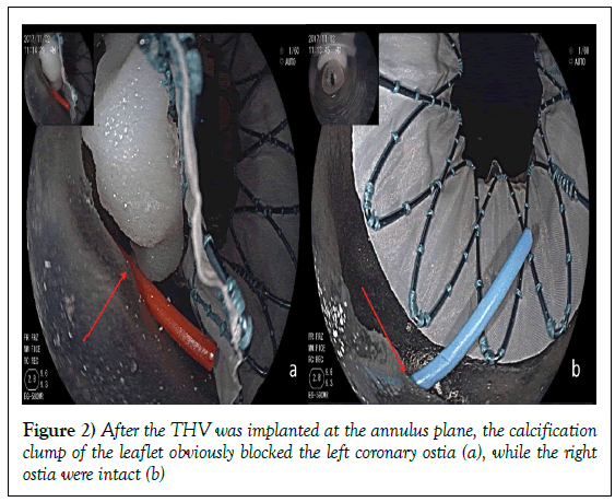 The necessity of applying 3D printing technique to the preoperative ...