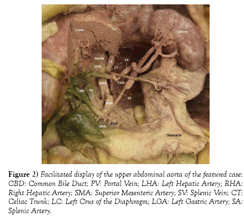 Branching pattern variations of the celiac trunk and superior ...